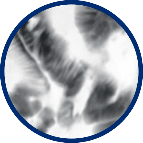 Next-Generation Cellvizio® -- Real-Time In Vivo Cellular Imaging Platform